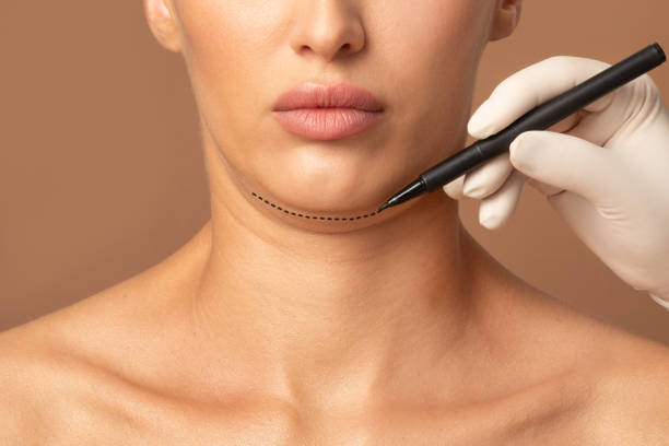AskOliveJames - Transform Your Skin: 10 Strategies to Firm Up Your Neck ...
